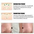 Eelhoe Blackhead Removal Nose Sticker Clean Pore Acne Blackhead T Zone
