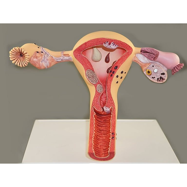 Ovary Model Anatomy