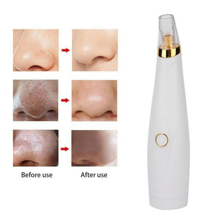 Fdit Face Pore Cleaner,Electric Blackhead Removal Beauty Instrument ...