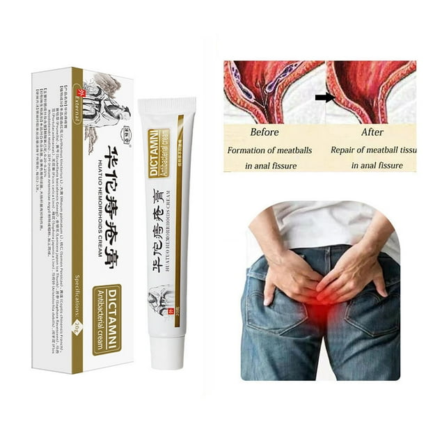 Hemorrhoids Itching Relief