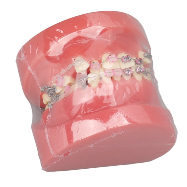Modelo de dientes, modelo dental de ortodoncia de demostración Modelo ...