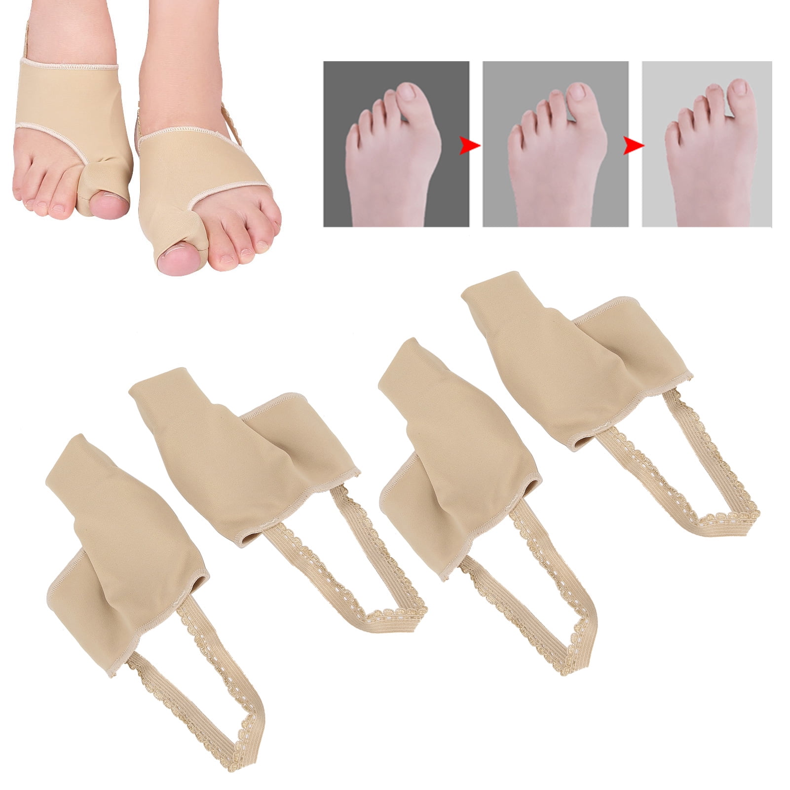 Click here for Ymiko 2 Pairs Hallux Valgus Correction Big Toe Sep... prices