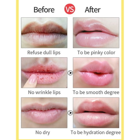 Exfoliation Lip Scrub Balm Lip Exfoliator Scrubs Softening Keratin ...