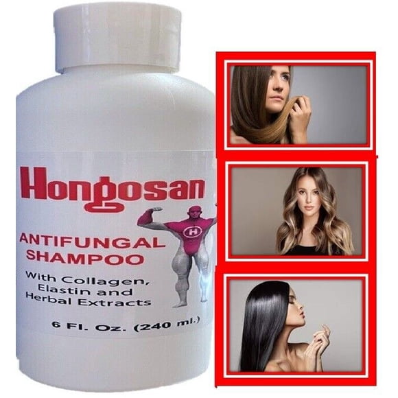 Ketoconazole Shampoo