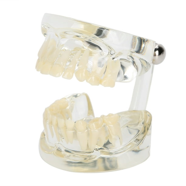 Teeth Model Deciduous Teeth Model Removable Tooth Model Removable Teeth ...