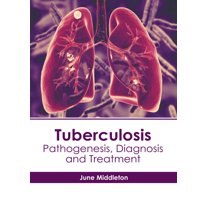 Tuberculosis: Pathogenesis, Diagnosis and Treatment (Hardcover ...