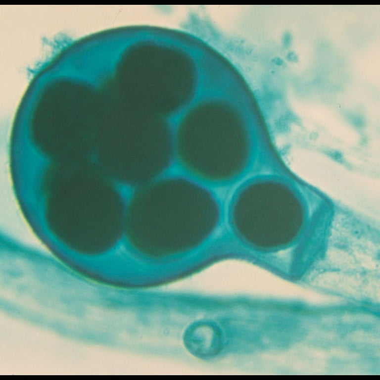 Yeast Slide Microscope