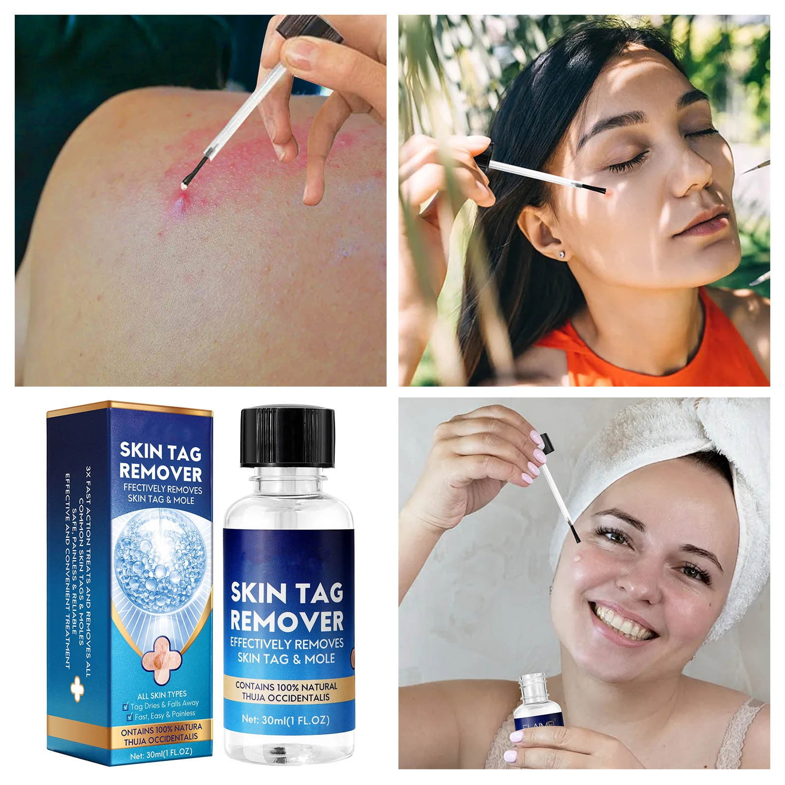 Bagmrteho Warts Liquid Nitrogen Rose Shampoo Well People Loose Belly ...