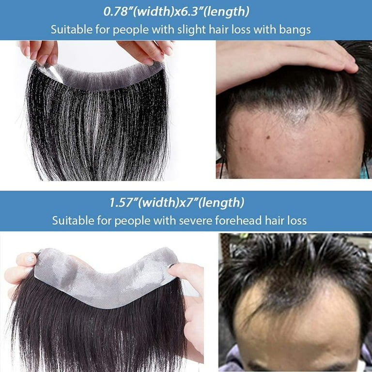 Straight Hairline Black People