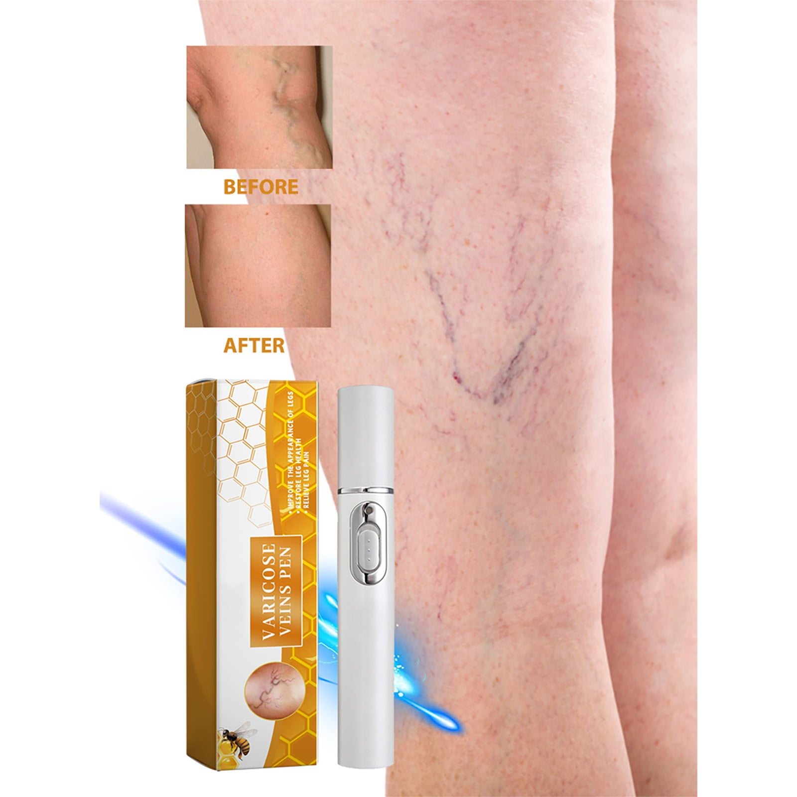 Click here for Cyc Home Trea Tment Set Blue Light Varicose Vein T... prices