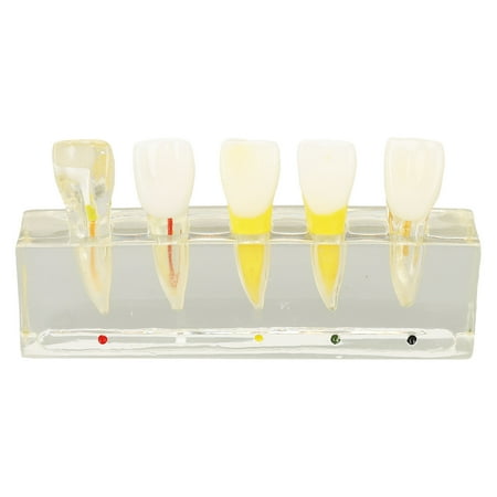 Dental Endodontic Model,Dental Pulp Cavity Model Dental Pulp Model ...