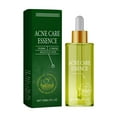 Acne Care Concentrate,Acne Clearing Concentrate,Gentle Acne Removing ...