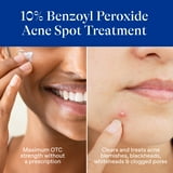 Differin Acne Spot Treatment with 10 Benzoyl Peroxide for Face and Body ...