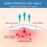 2 Rolls Hydrocolloid Roll for Wound Care, 2in x 16.5ft Self-Adhesive ...