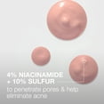 Neutrogena Stubborn Acne Spot Drying Treatment, 10% Sulfur, Overnight ...