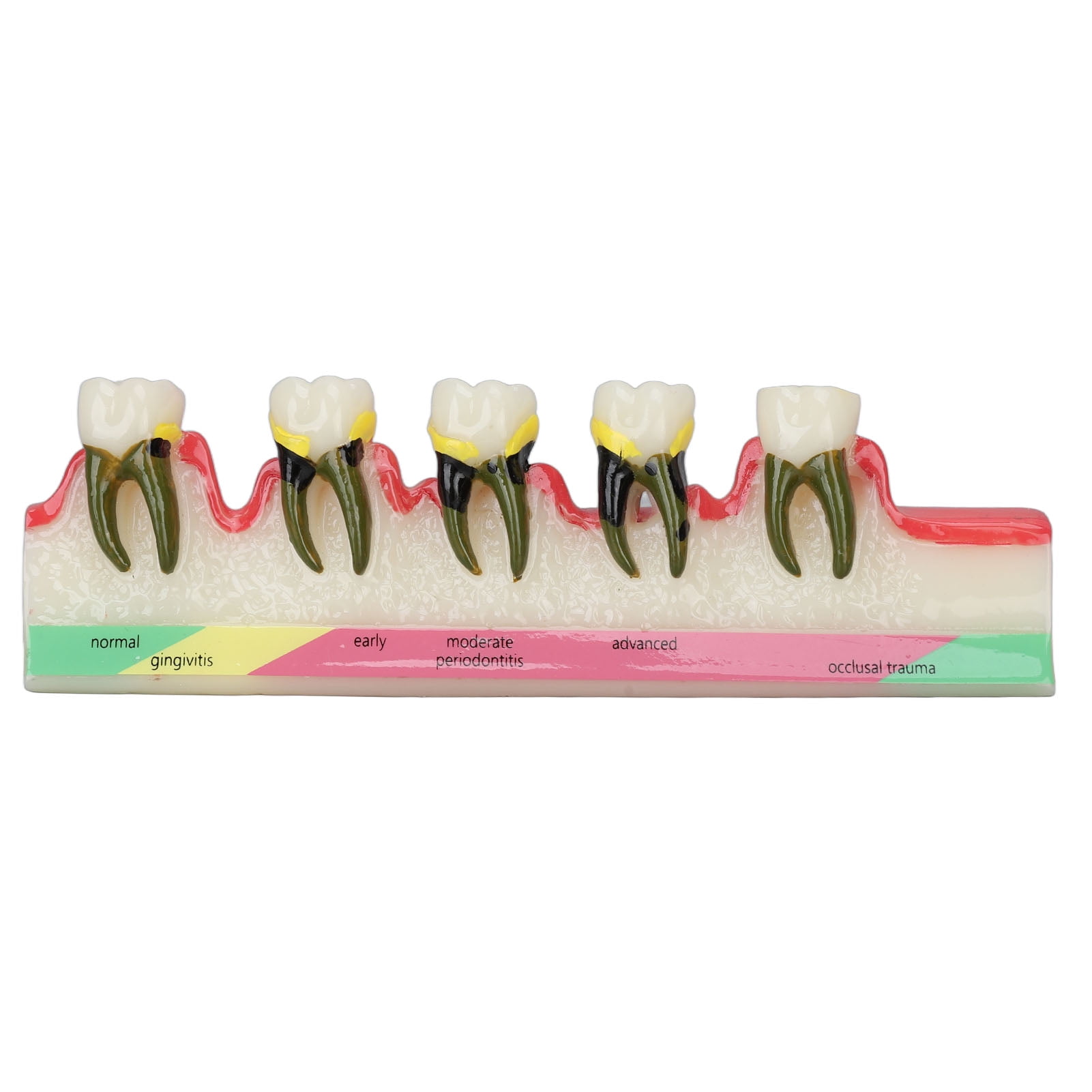 Modelo de dientes dentales, estructura clara de cerámica, cuidado bucal ...