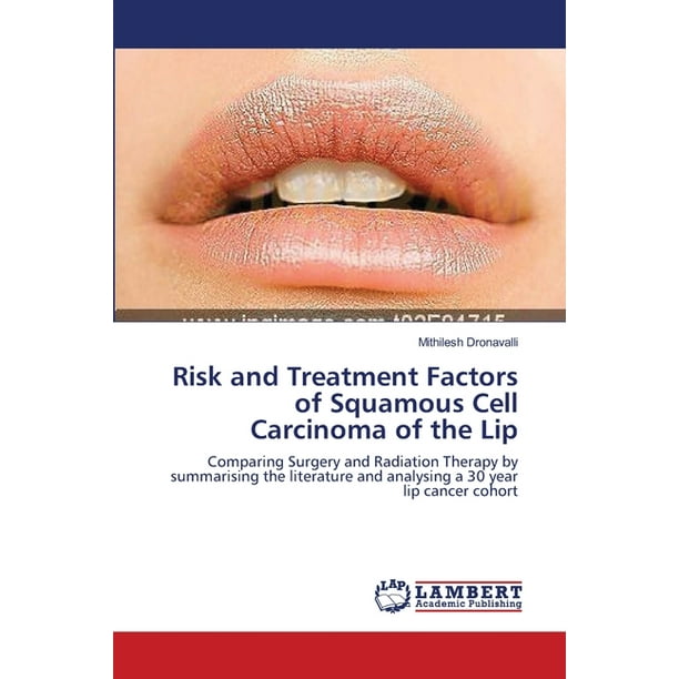 Squamous Cell Carcinoma Lip