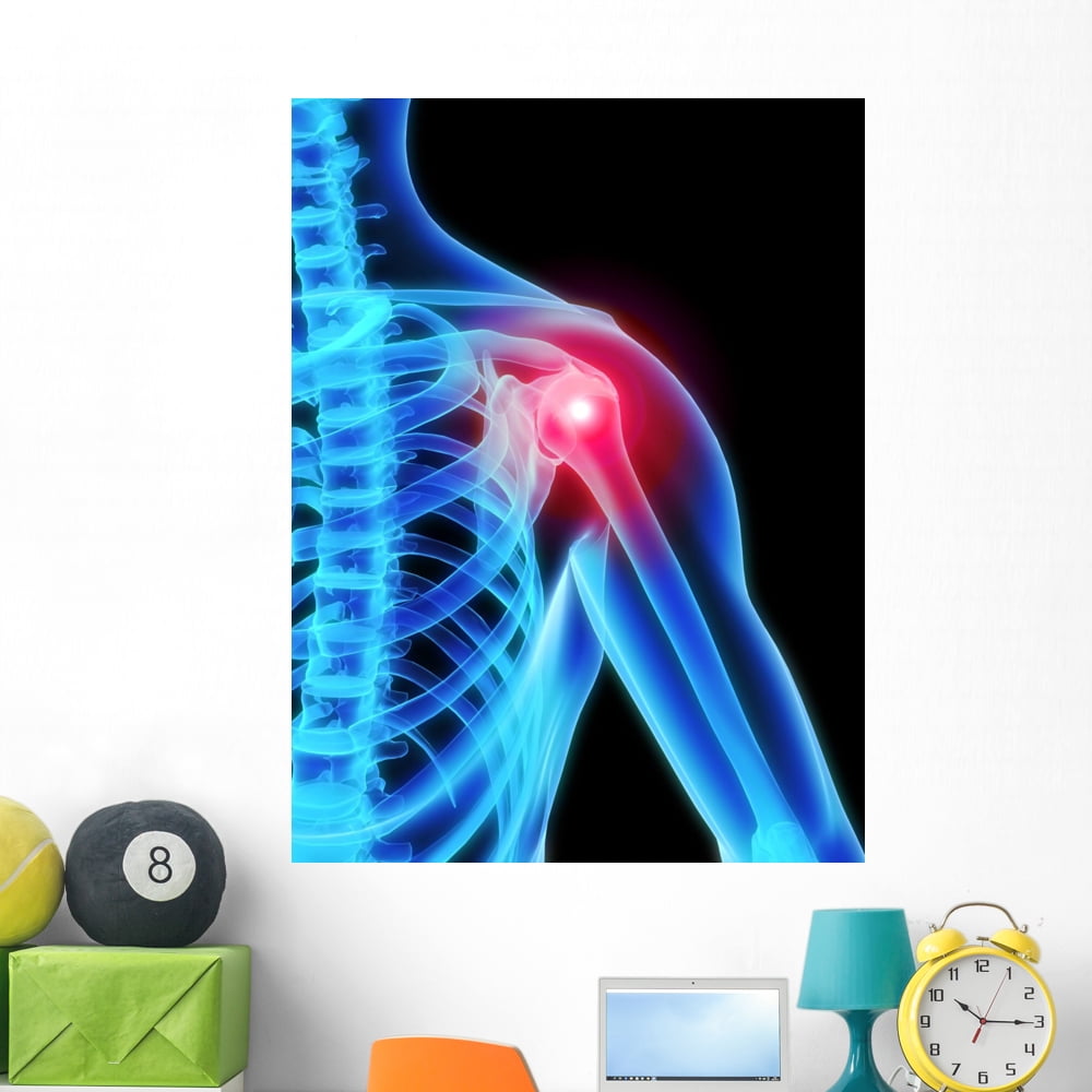Shoulder Pain X-ray Wall Mural by Wallmonkeys Peel and Stick Graphic ...