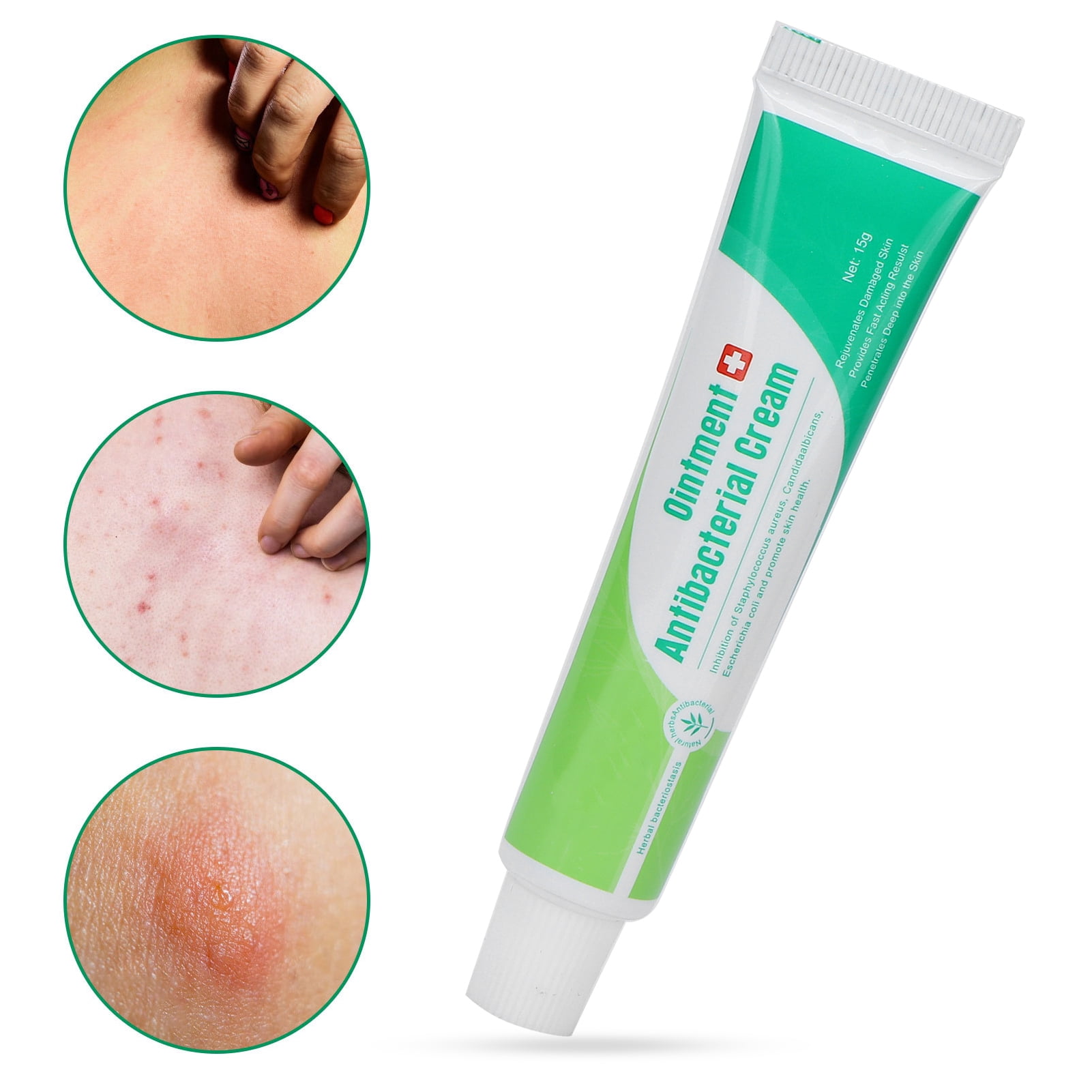 Crema para Aliviar la Picazón Ayuda a Detener la Picazón Rápidamente ...