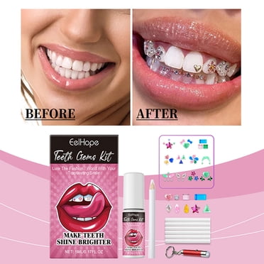 SDJMa Tooth Gem Kit,Professional Tooth Gems Kit for Teeth, Starter ...