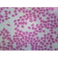 AmScope Microscope Stage Calibration Slide for USB Camera 0.01mm Stage ...