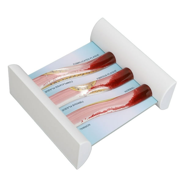Lipoprotein Blood Vessel Model, 3 Modes Lipoprotein LDL Blood Vessel ...