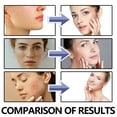 ManxiVoo 377 Melasma Lighten Skin Tone Improve Dull Skin Dark Spots ... ManxiVoo 377 Melasma Lighten Skin Tone Improve Dull Skin Dark Spots ...