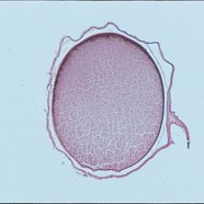 Marine Diatoms Prepared Microscope Slide, Whole Mount - Walmart.com