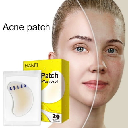 Archer 20Pcs/Set Acne Removal Patch Blemish Covers Unclog Pores Skin ...