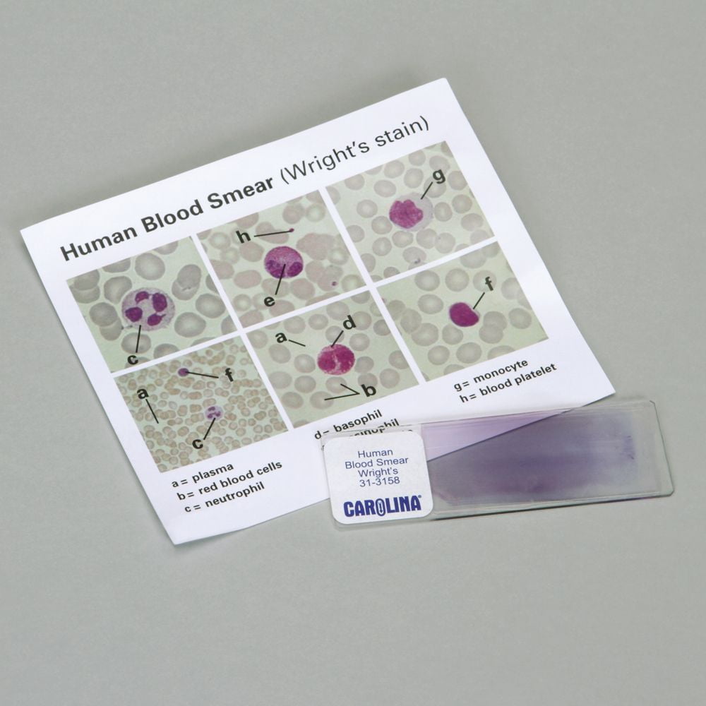 Buy Discovering Human Blood Self-Study Unit, Microscope Slide Set ...
