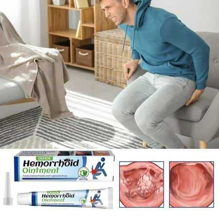 Hemorrhoid Cream Broken Hemorrhoid Cream Elimination Meat Ball Anal ...