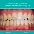 Opalescence Go 15% Hydrogen Peroxide Whitening Kit - Prefilled Trays ...