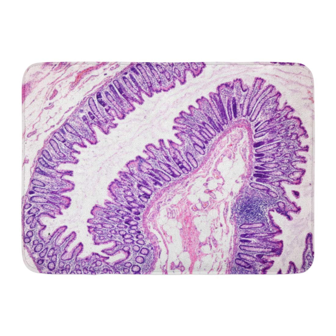 GODPOK Pink Mucosa Layer of The Large Intestine with Lieberk脙录hn Crypts ...