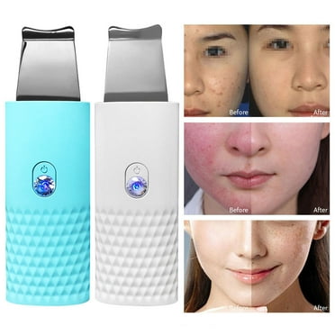 Tanda Zap Acne Spot Treatment Device - Walmart.com