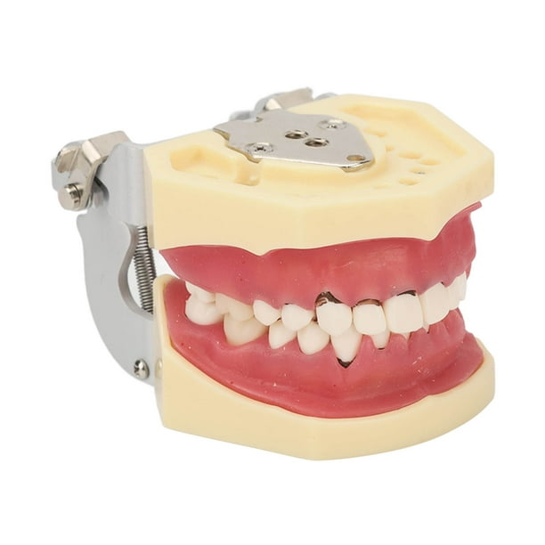 Demonstration Denture Model,Periodontal Disease Teeth Resin Periodontal ...