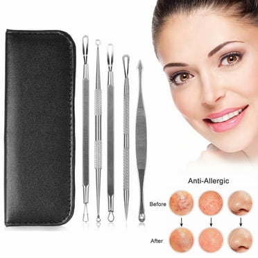 Blackhead Acne Comedone Pimple Blemish Extractor Remover Stainless Tool ...