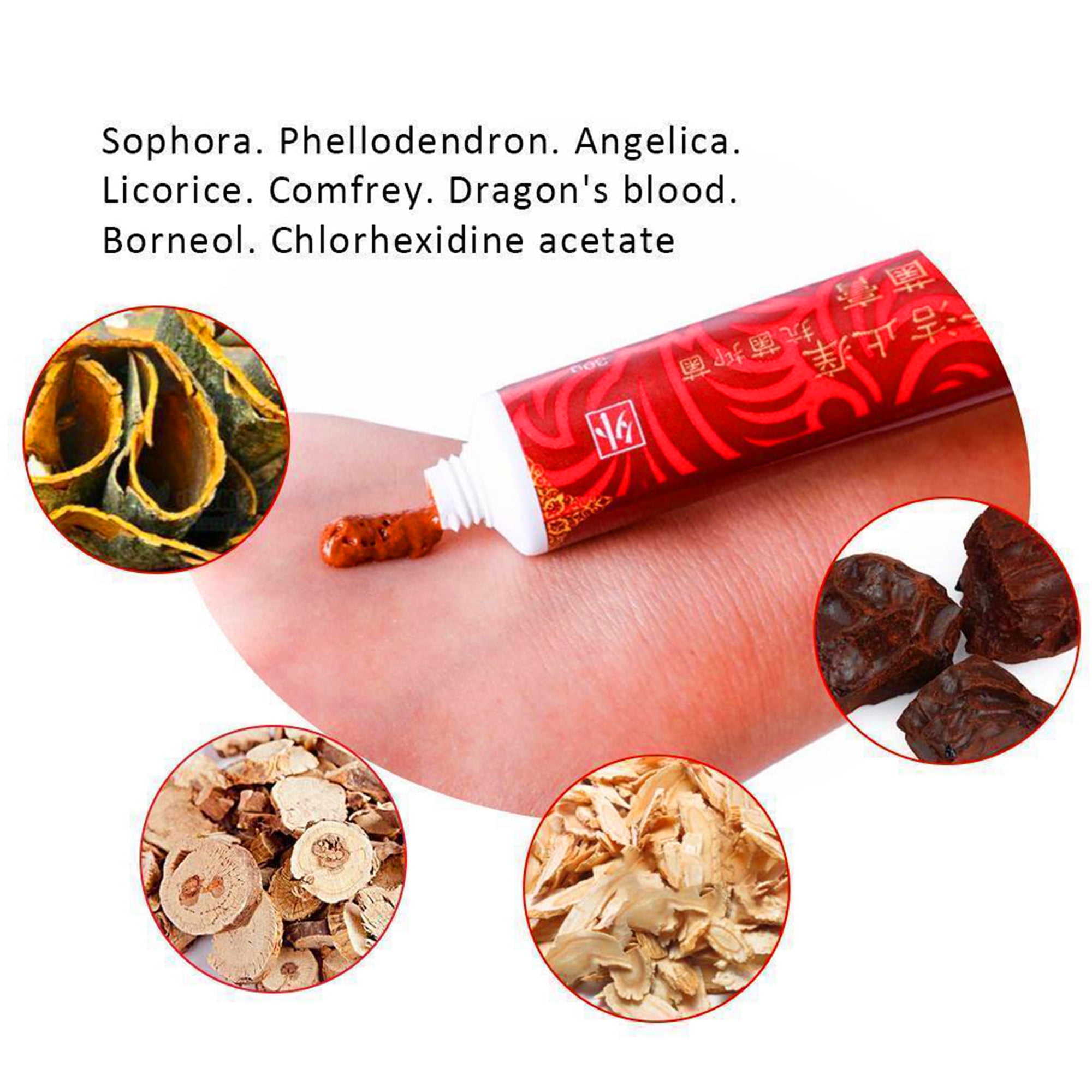 Buy Varicose Vein Cream Phlebitis Angiitis Inflammation Itching Lumps ...