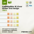 Gallbladder & Liver Testing Kit, 50 Count Test Strips for Urobilinogen ...