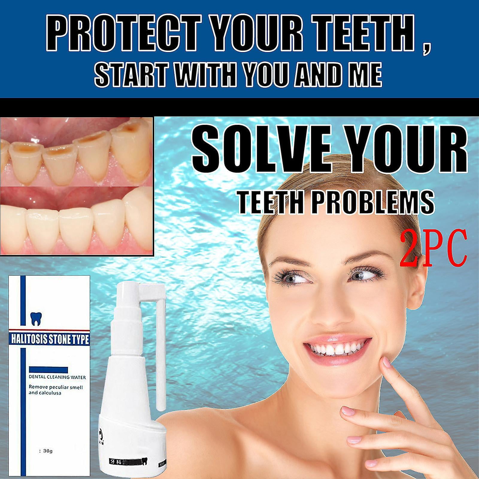 Dentaling Calculus Dissolving Spray Deodorizing Dentaling Calculus ...