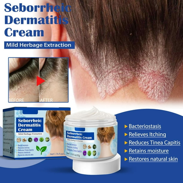 BAODANFU Seborrheic Skin Paste Is Applicable To Skin Inflammation ...