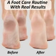 The Foot Medic, Extra Large Collapsible Foot Bath, 16.9x12.8 Inch ...