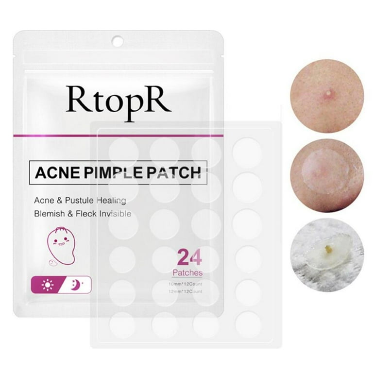 Acne Pustule