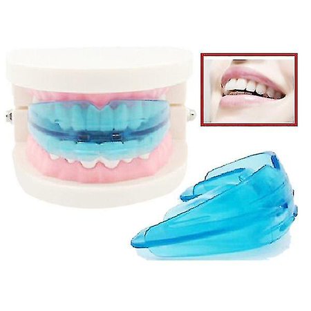 Dental Braces Orthodontic Retainer Orthodontic Facings Make Corrections ...