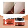 Costeam Acne Soothing Cream 1.23 Ounce Calming Formula Reduces Blemish ...