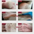 Heel For Rough Dry & Chapped Feet Heel Skin Callous Eliminator for Feet ... Heel For Rough Dry & Chapped Feet Heel Skin Callous Eliminator for Feet ...