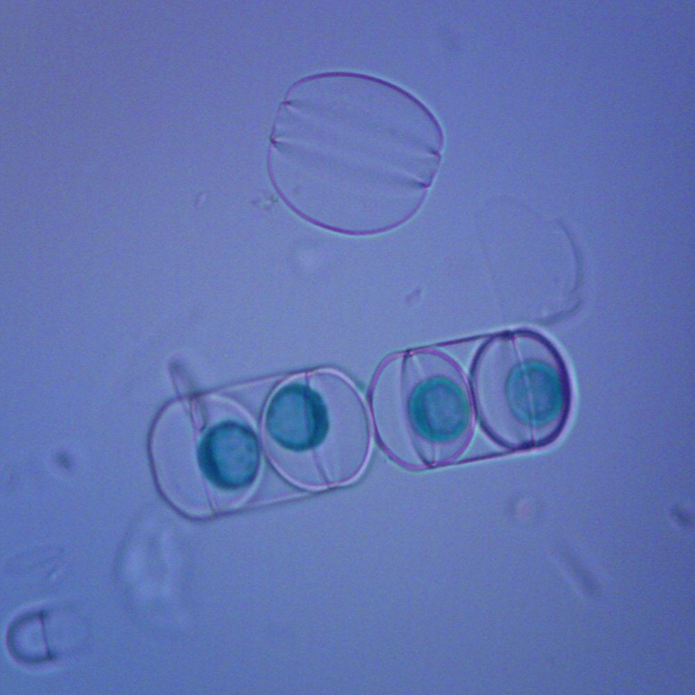 Diatom Cell Slide