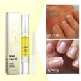 TYTSPEASY 2ML Nail Care Solution Effectively Nourishes Nails And Is ...