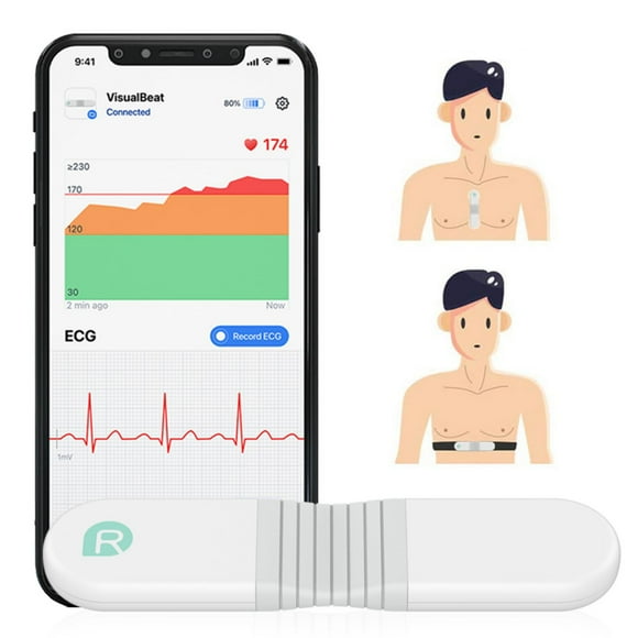 Home Ekg Monitor