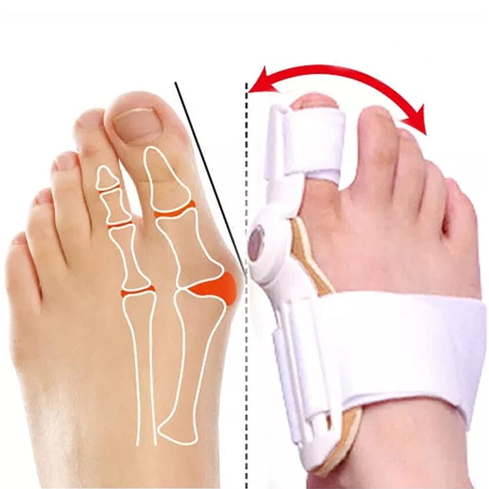 Click here for Unbranded Bunion Corrector hallux Valgus Splint Va... prices