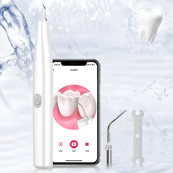 Tonsil Stones Removal